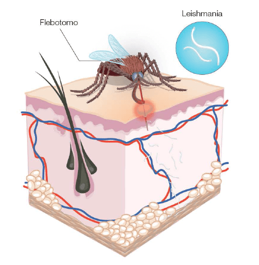 Leishmaniasis