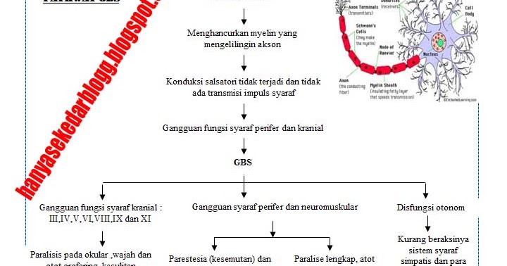 Pathway GBS ( GUILLAIN BARRE SYNDROME)