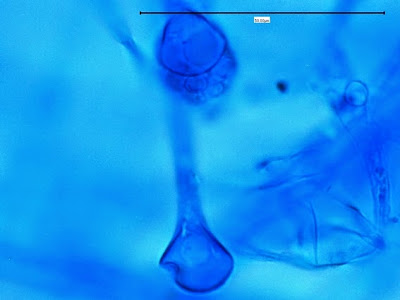 Fun With Microbiology (What's Buggin' You?): Apophysomyces elegans ...