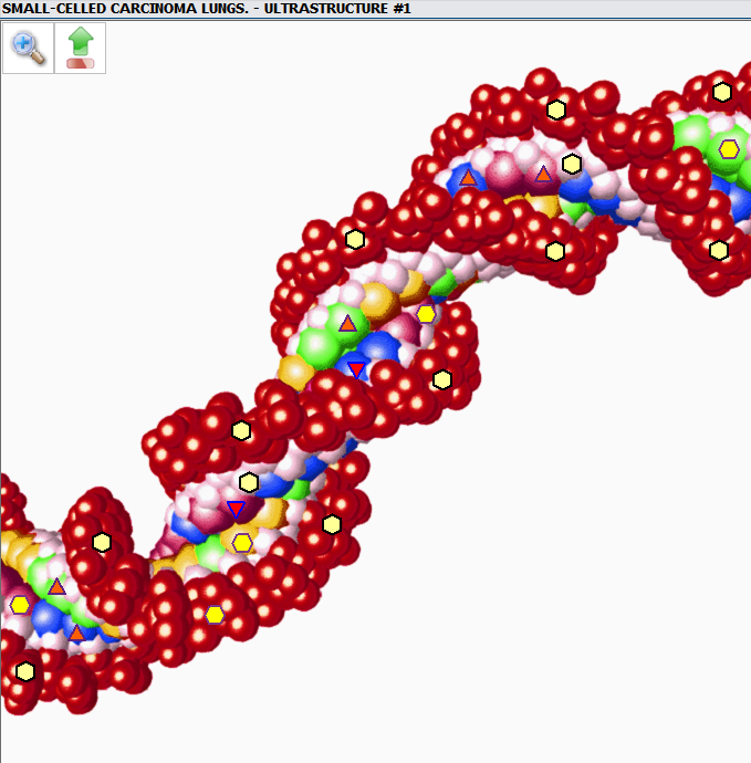 Η ΕΠΙΣΚΕΨΗ ΤΟΥ ΚΑΡΚΙΝΟΥ Σ' ΕΜΕΝΑ ΚΑΙ ΠΩΣ ΤΟΝ ΑΠΕΦΥΓΑ! - Ολοσυντονισμός ...