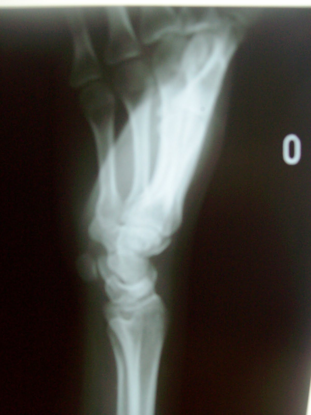 Rx011: Proyecciones Muñeca