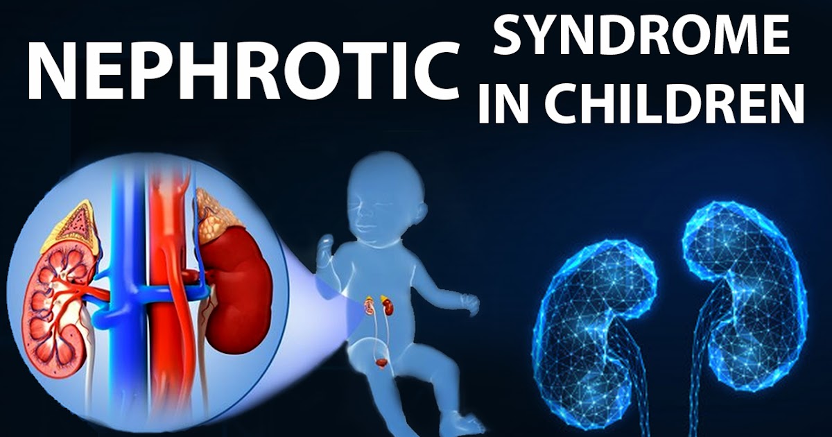 NEPHROTIC SYNDROME IN CHILDREN