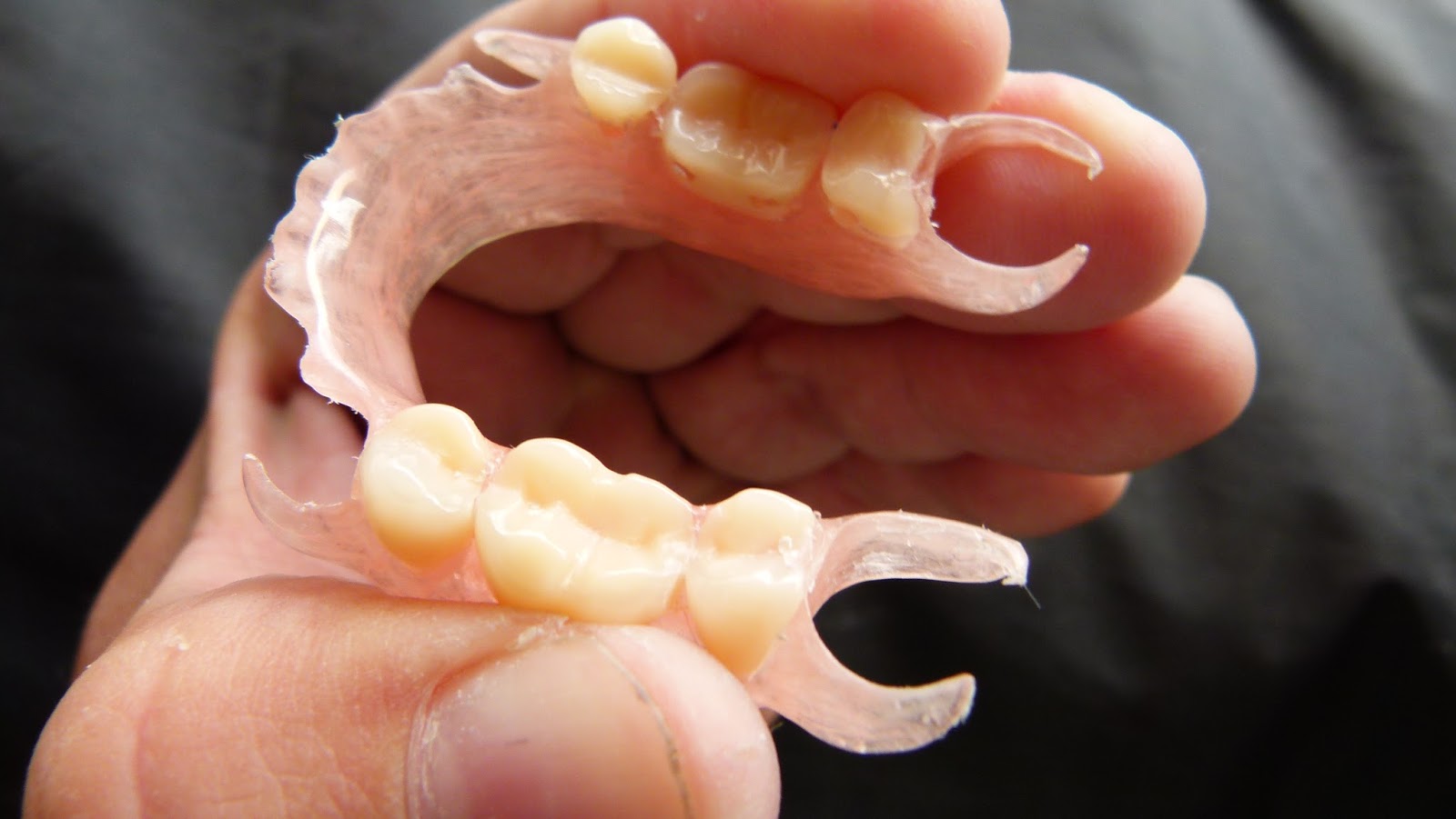 Protese Parcial Removivel Flexivel - RETOEDU