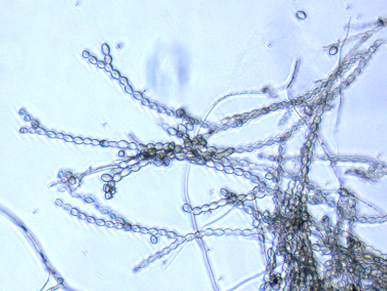 plant pathology 631 lab report: Lab 5 Mitosporic fungi survey