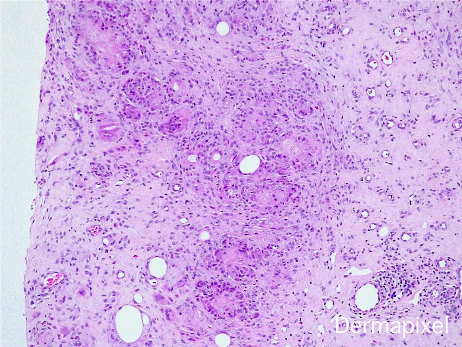 Dermapixel: diciembre 2020