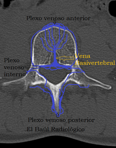 El Baúl Radiológico: VENAS BASIVERTEBRALES. (Basivertebral Veins: CT ...