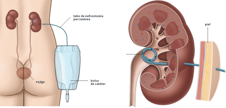 ANATOMIA APLICADA 20/21: BLOQUE 3. APARATO EXCRETOR. FISIOLOGÍA. EQUILIBRIO HÍDRICO Y ...