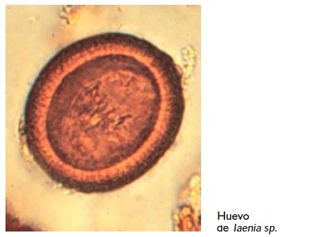 Parasitosis por Tenia Solium: Teniasis