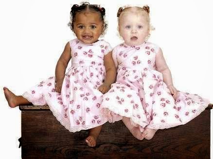 Cajón de Sastre Misterioso: LAS GEMELAS KIAN Y REMEE, UNA NEGRA Y LA ...