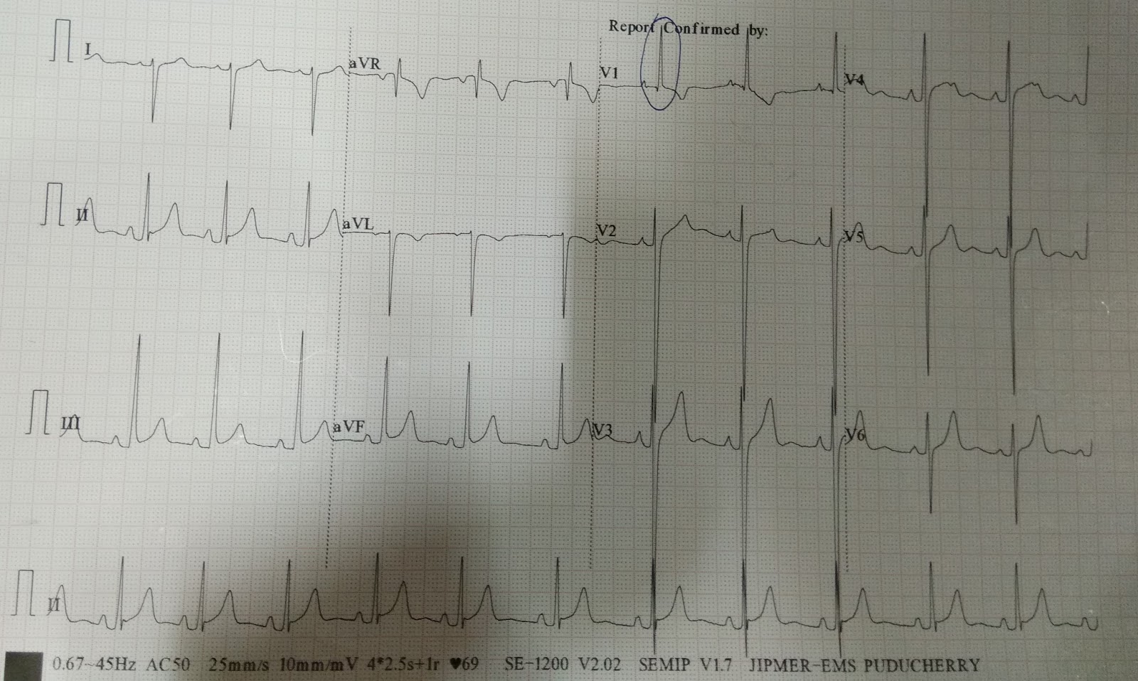 Cardiology window: Congenital heart diseases-Tetralogy Of fallot
