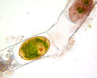 BIOLOGY NOTES 11/12: SPIROGYRA