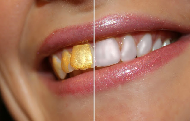 blushing basics: If You're Not Whitening, You're Yellowing {Giveaway}