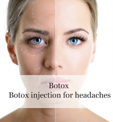 Botox / Botox injection for headaches/ Botox for tension headaches