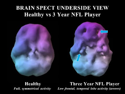 The Neurocritic: April 2016