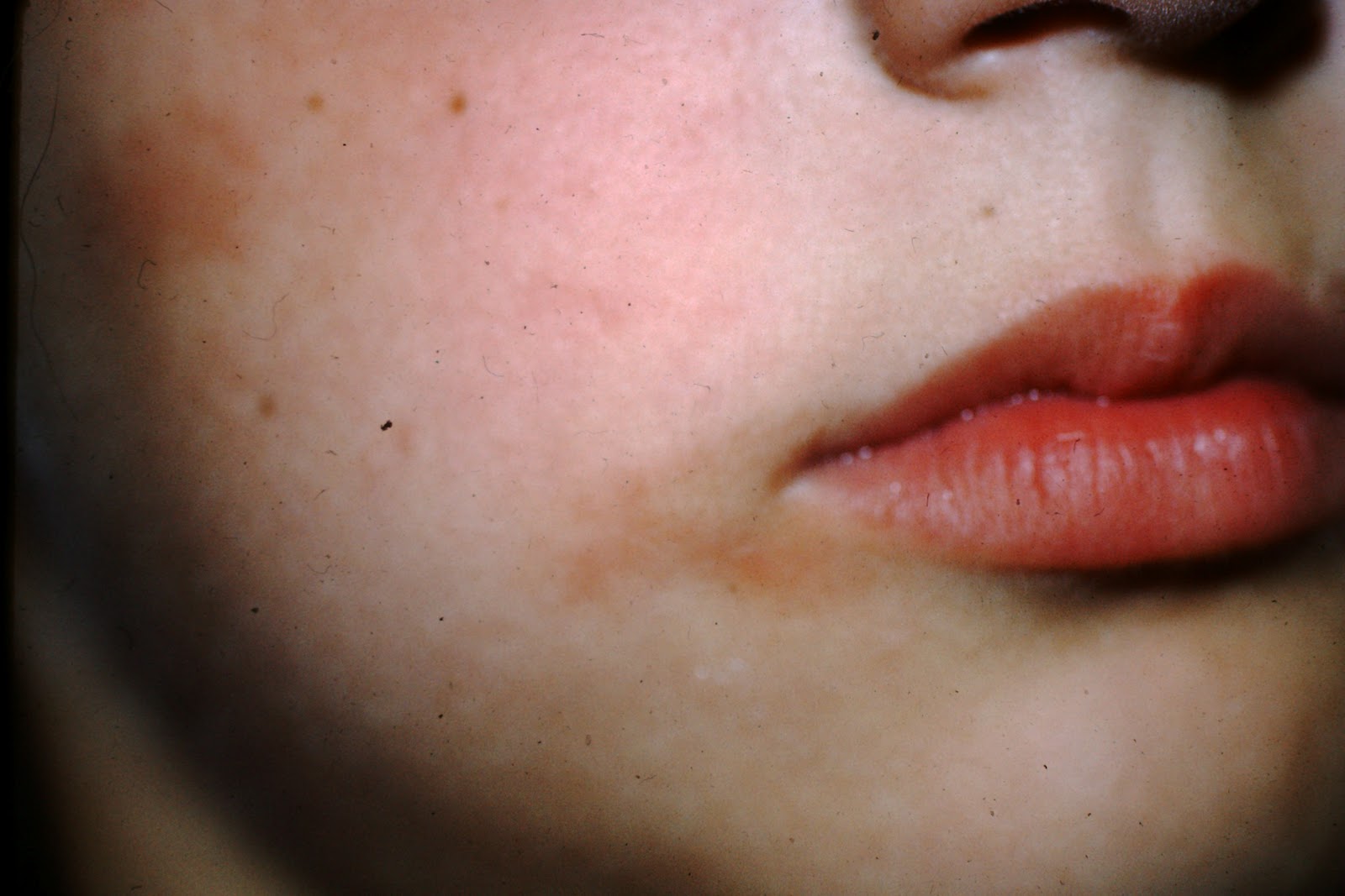 Derm Challenge