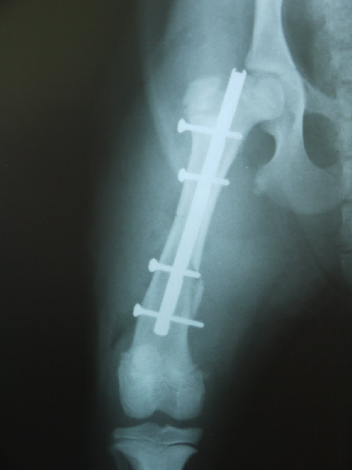 Traumatologia y Cirugia Ortopedica Veterinaria: FRACTURA DE FEMUR EN ...