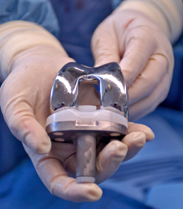 Trey Smith 20% Project: Knee Replacements