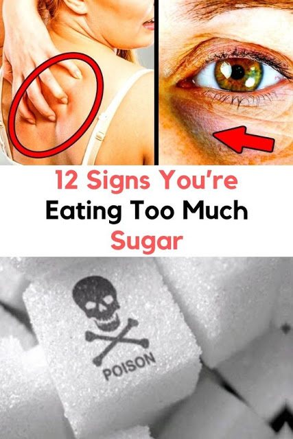 12 Signs You’re Eating Too Much Sugar - medicine health life