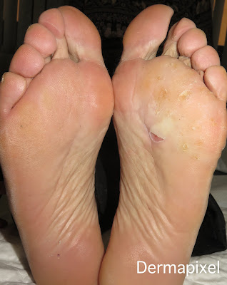 Dermapixel: junio 2019