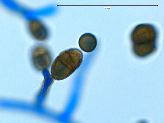 Fun With Microbiology (What's Buggin' You?): July 2015