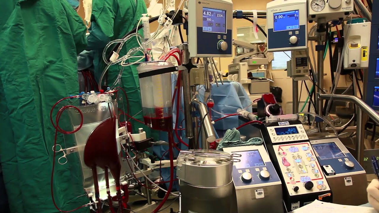 ( Heart-Lung Machine)جهاز القلب و الرئتين