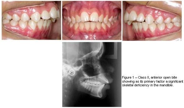 Ramin Mehregan D.M.D.: NEUROMUSCULAR APPROACH IN THE TREATMENT OF ...