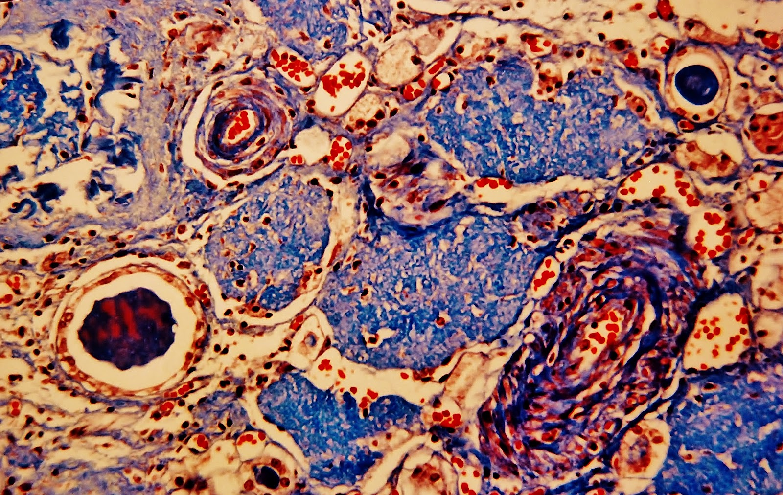 HISTOPATOLOGIA FORENSE PRACTICA (FORENSIC PATHOLOGY FORUM): 115.1 ...