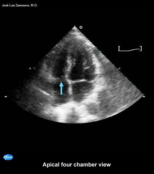 Echocardiography (USG Jantung)