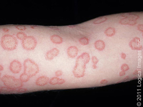 EL RINCÓN DE LA MEDICINA INTERNA. juanpedromacaluso@yahoo.com.ar ...