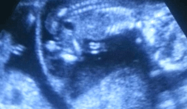 Mitos Hamil Anggur Dan Pengenalannya