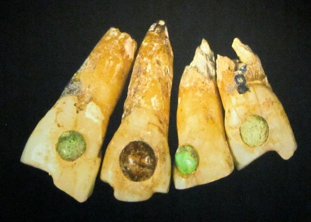 The Mayans Used to Decorate Their Teeth by Place Carved Stone Inlays ...