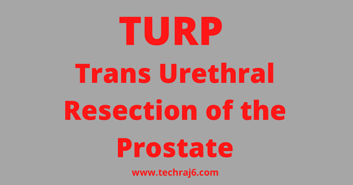 TURP full form, What is the full form of TURP