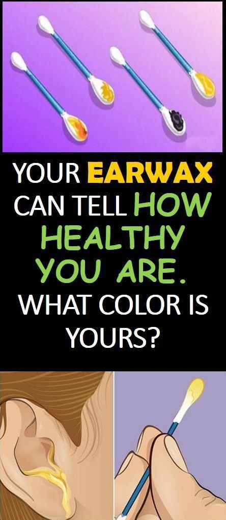 Your Earwax Can Tell How Healthy You Are. What Color Is Yours ...