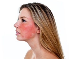 5 Signs That You're Over-Scrubbing Your Skin