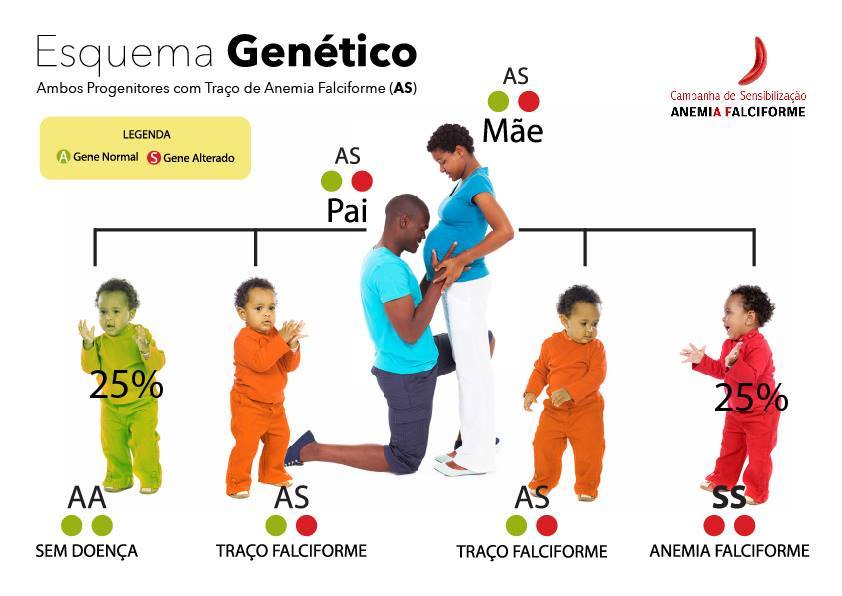 Enfermagem a arte de cuidar: ANEMIA FALCIFORME