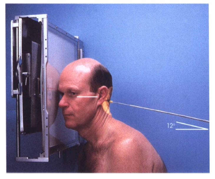 Catatan Ku: Teknik Radiografi Mastoid