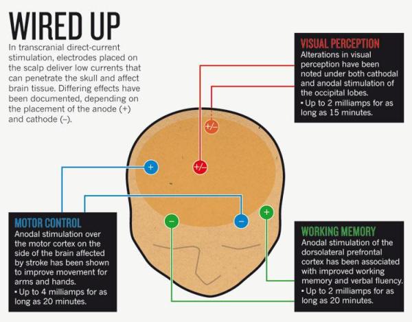 Al Fin The Next Level: Electromagnetic Brain Stimulation More Popular