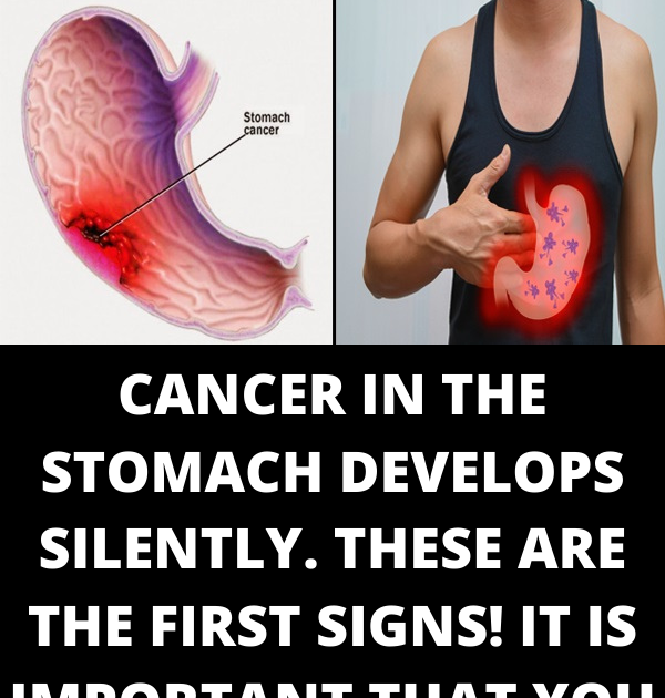 CANCER IN THE STOMACH DEVELOPS SILENTLY. THESE ARE THE FIRST SIGNS! IT ...