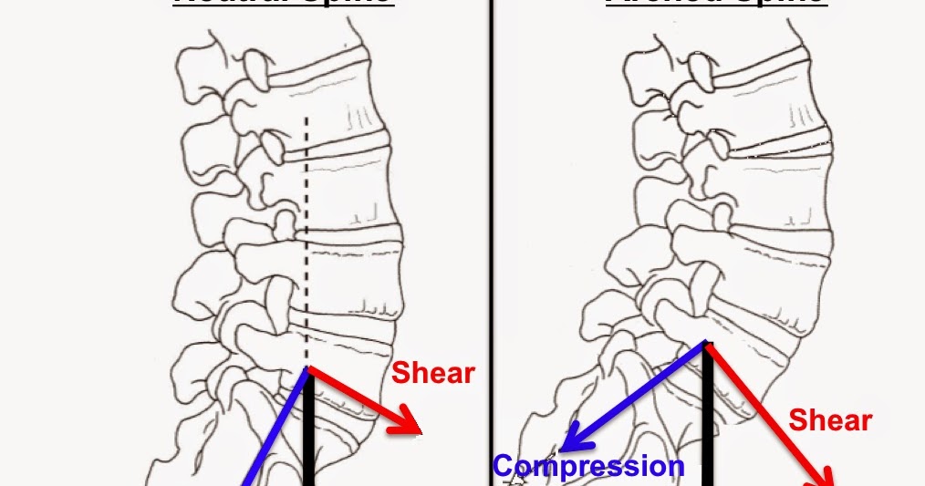 Fitness Pollenator: Brief Lessons in Biomechanics: Taking Care of the Spine