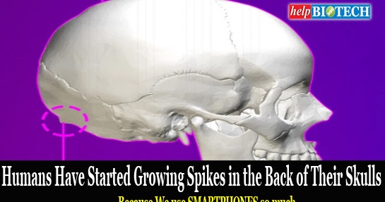 We are Growing Spikes in the Back of Skulls Because of Excessive Usage ...
