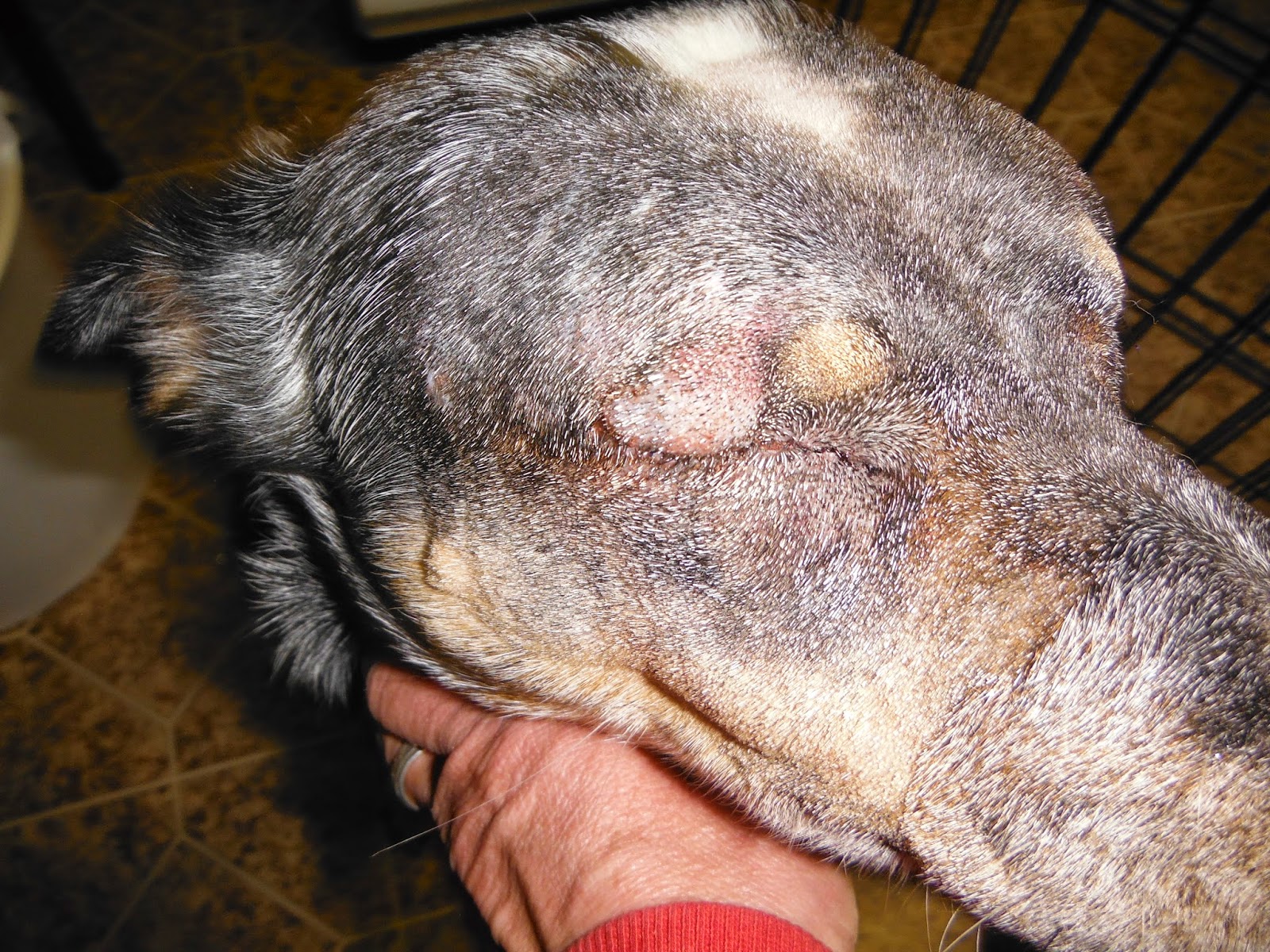 acd6pack: Bilateral Enucleation