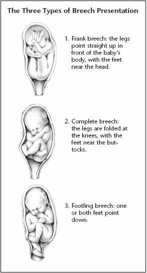 Barbora H Photography: Breech baby...