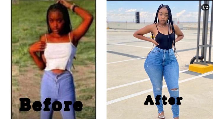 Surgery: Andiswa Selepe Before And Photos Of Thebomb RSA