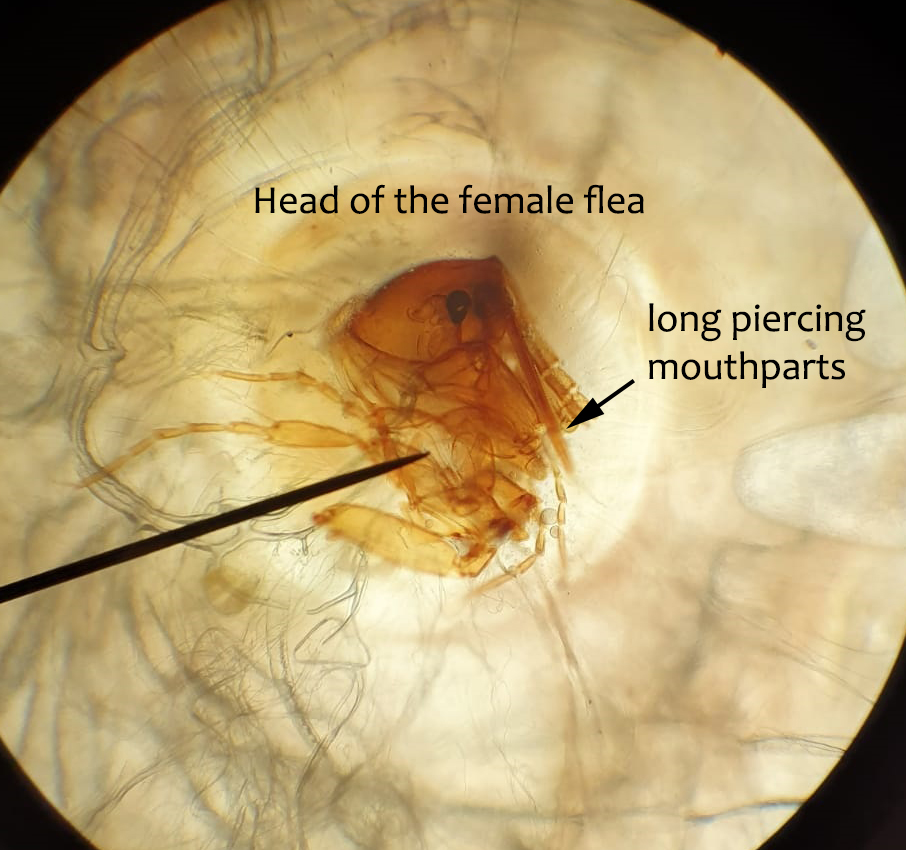 Creepy Dreadful Wonderful Parasites: Answer to Case 572