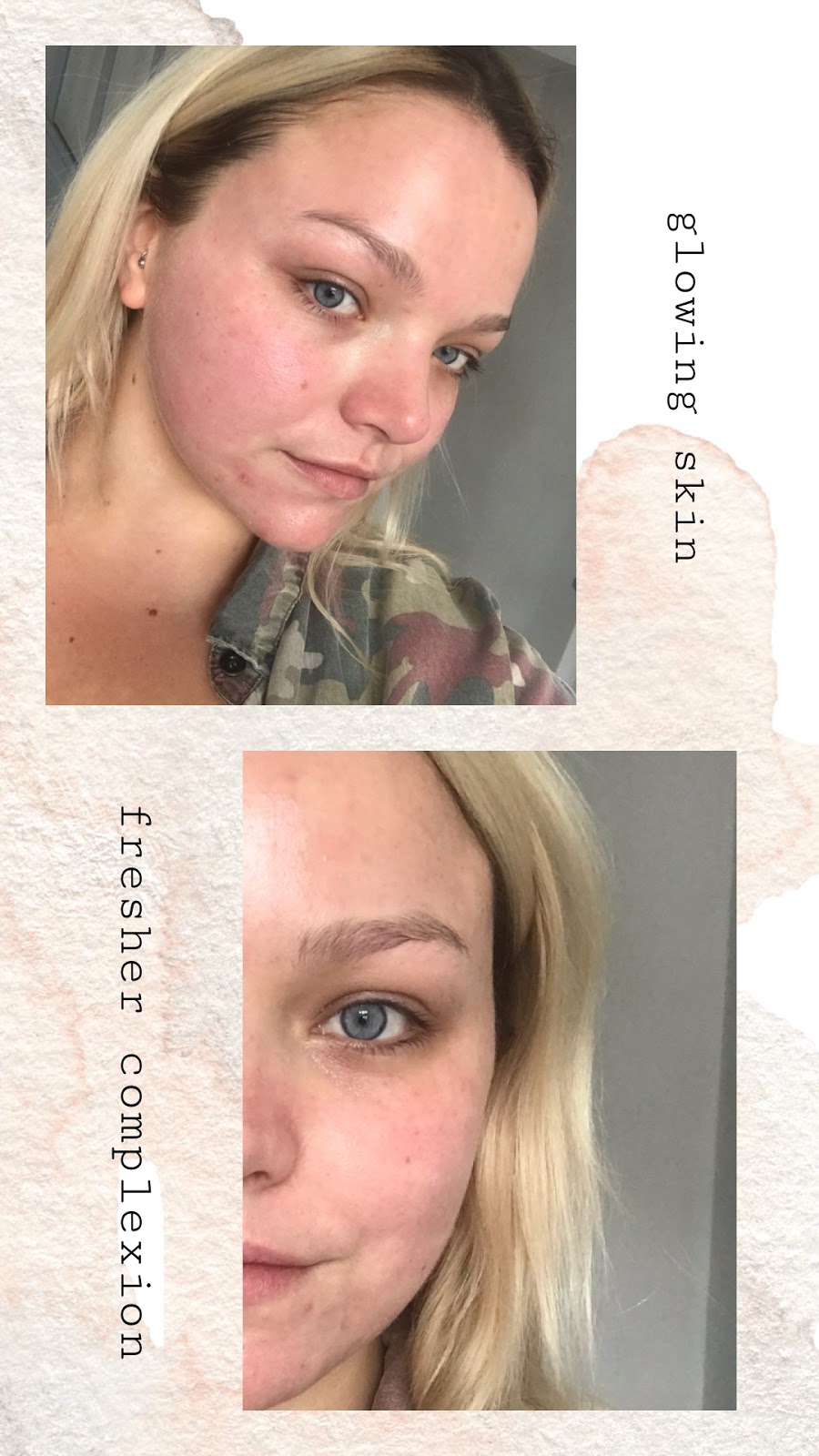 Dr Nyla Raja- Medispa Cheshire