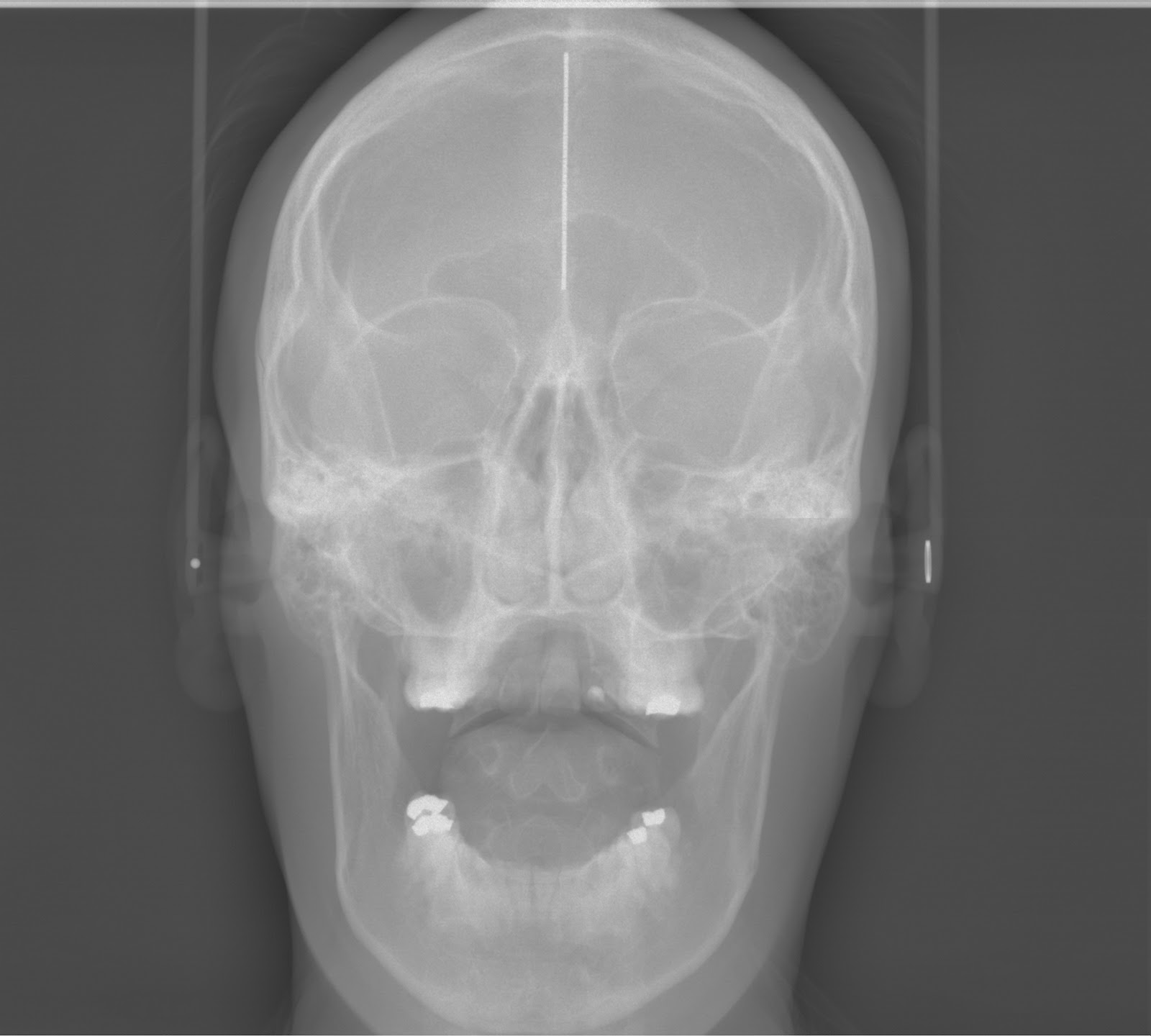 Radiología Oral y MaxiloFacial