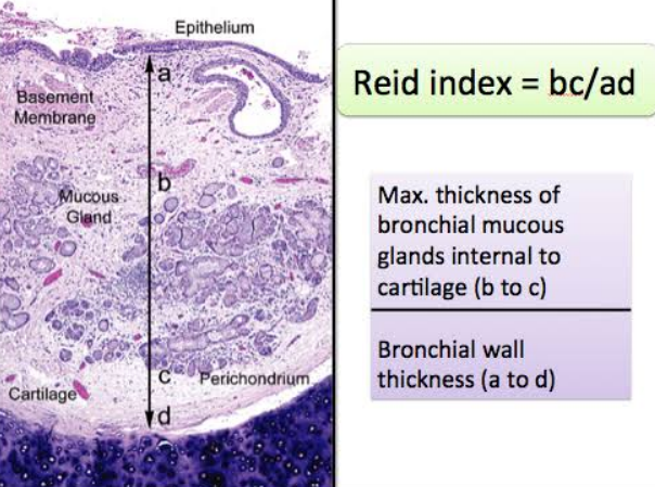 Reid Index