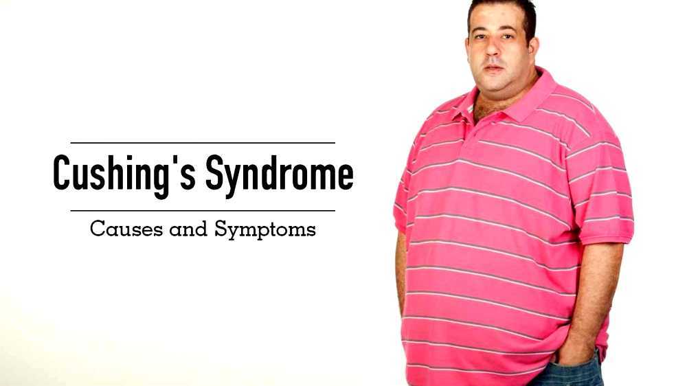 Cushing's syndrome