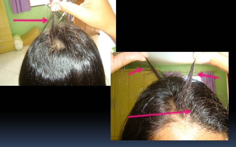 CORTE QUÍMICO E DOBRA QUÍMICA - QUAL A DIFERENÇA ENTRE ELES? | Clube do ...