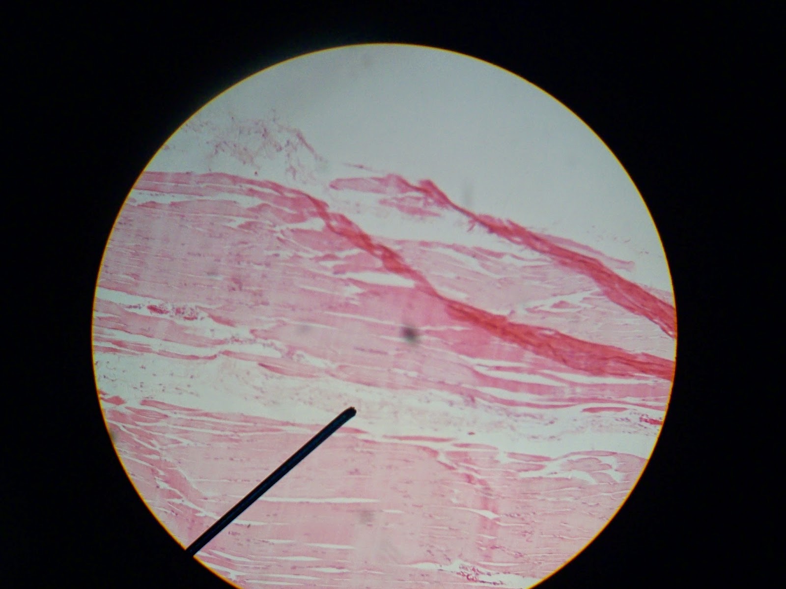 HISTOLOGIA MEDICINA UCC PASTO: MUSCULAR